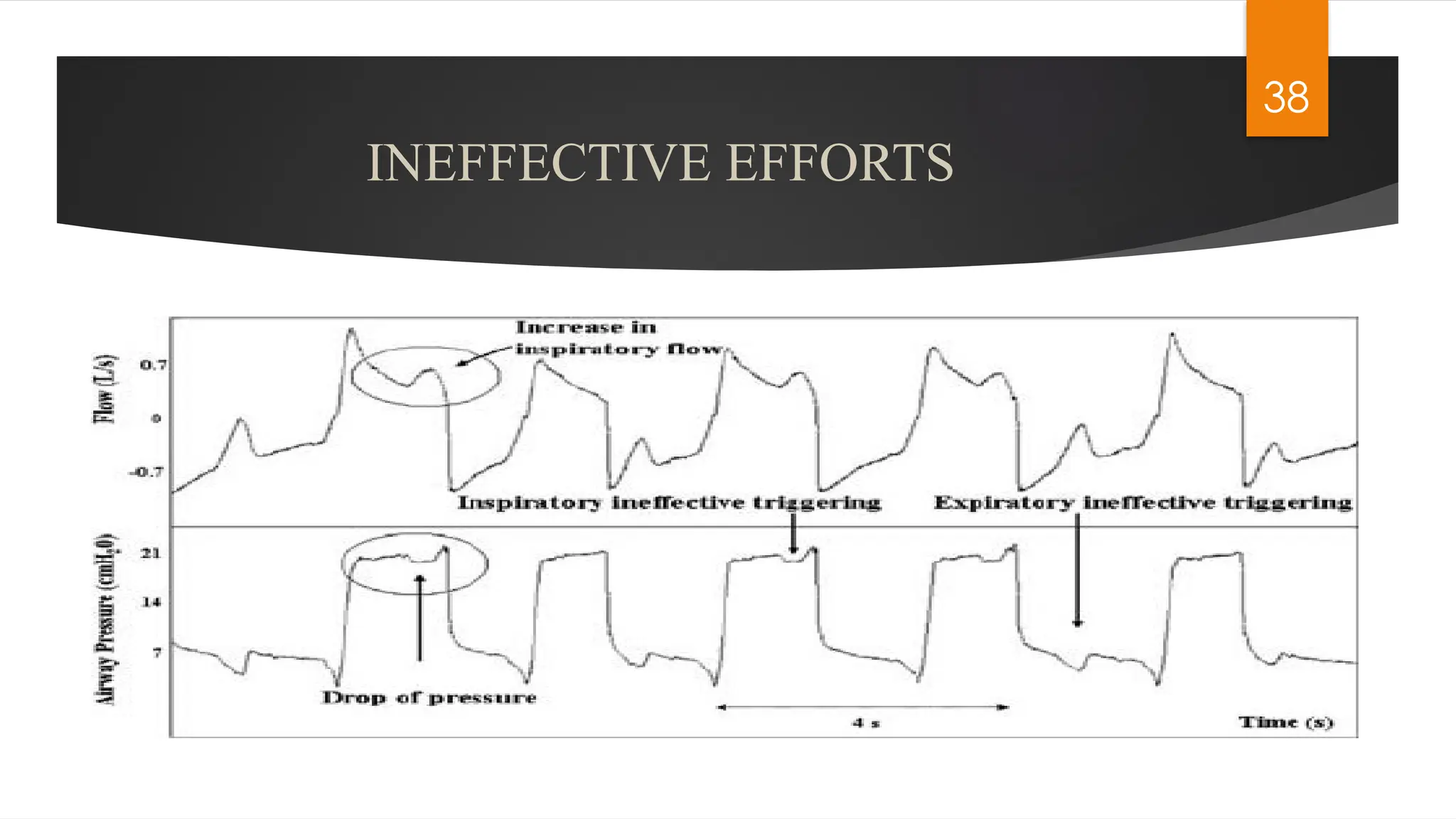 VENTILATOR GRAPHICS,Purposes of monitoring graphics | PPTX