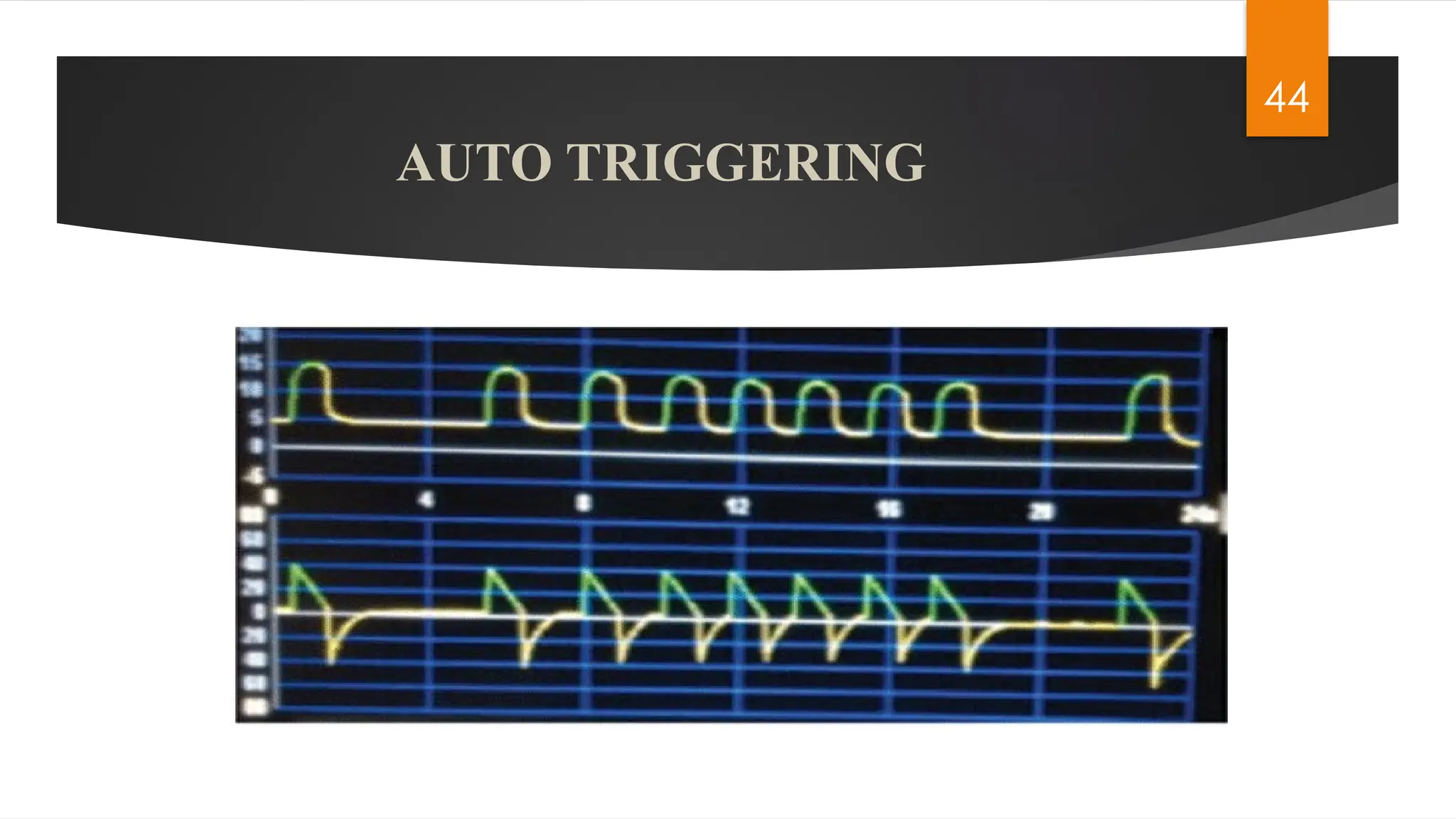 VENTILATOR GRAPHICS,Purposes of monitoring graphics | PPTX