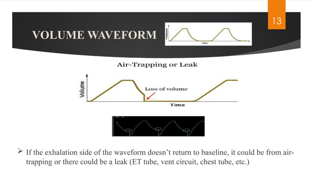VENTILATOR GRAPHICS,Purposes of monitoring graphics | PPT