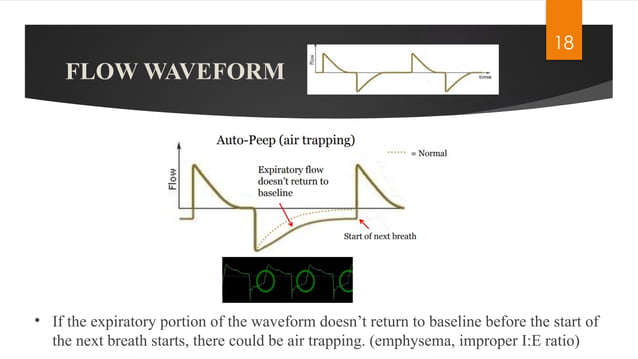 VENTILATOR GRAPHICS,Purposes of monitoring graphics | PPT