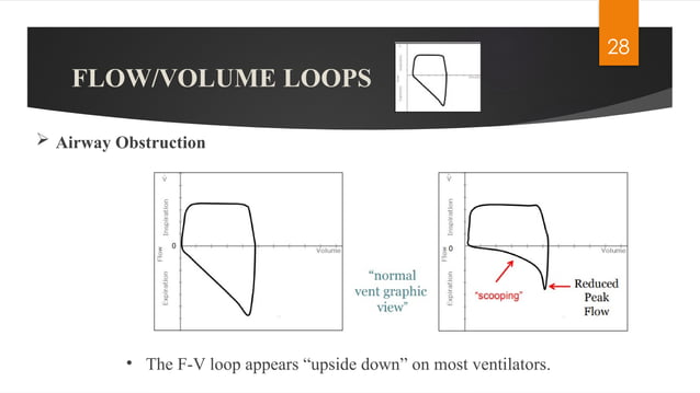 VENTILATOR GRAPHICS,Purposes of monitoring graphics | PPT