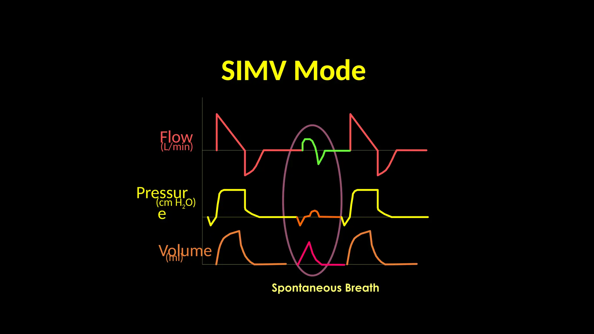 ventilator graphics in anesthesia machinepptx | PPT