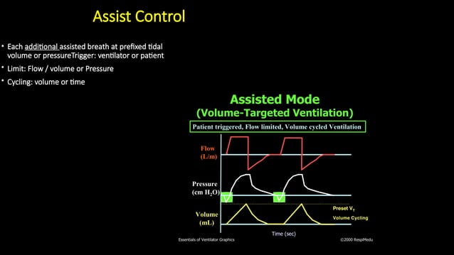 ventilator graphics in anesthesia machinepptx | PPT