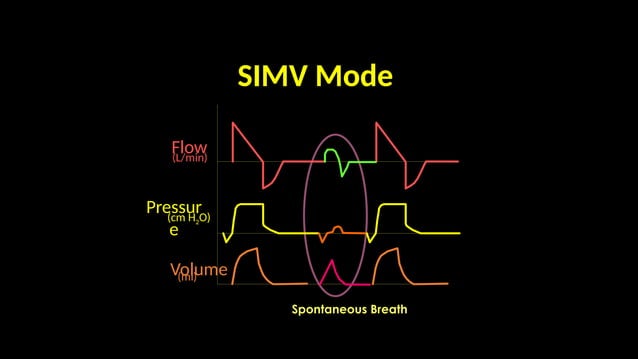 ventilator graphics in anesthesia machinepptx | PPT