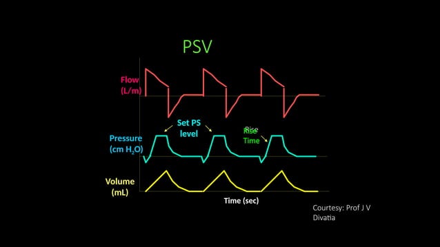 ventilator graphics in anesthesia machinepptx | PPT