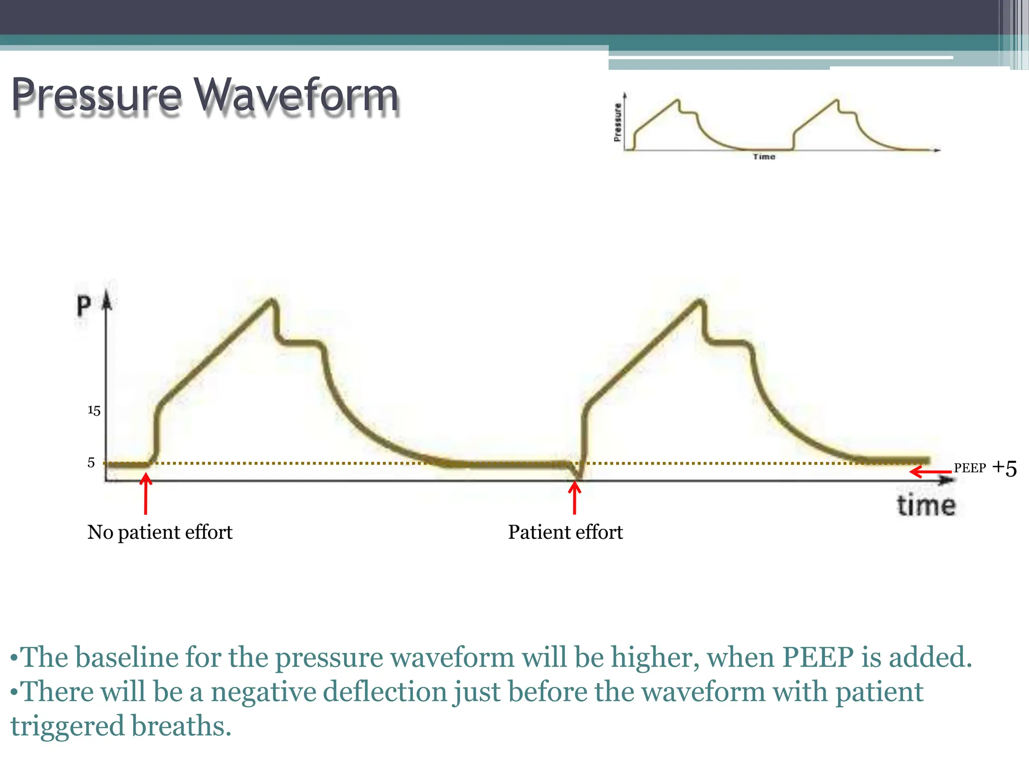 ventilator graphics in the ICU Patients ppt.pptx