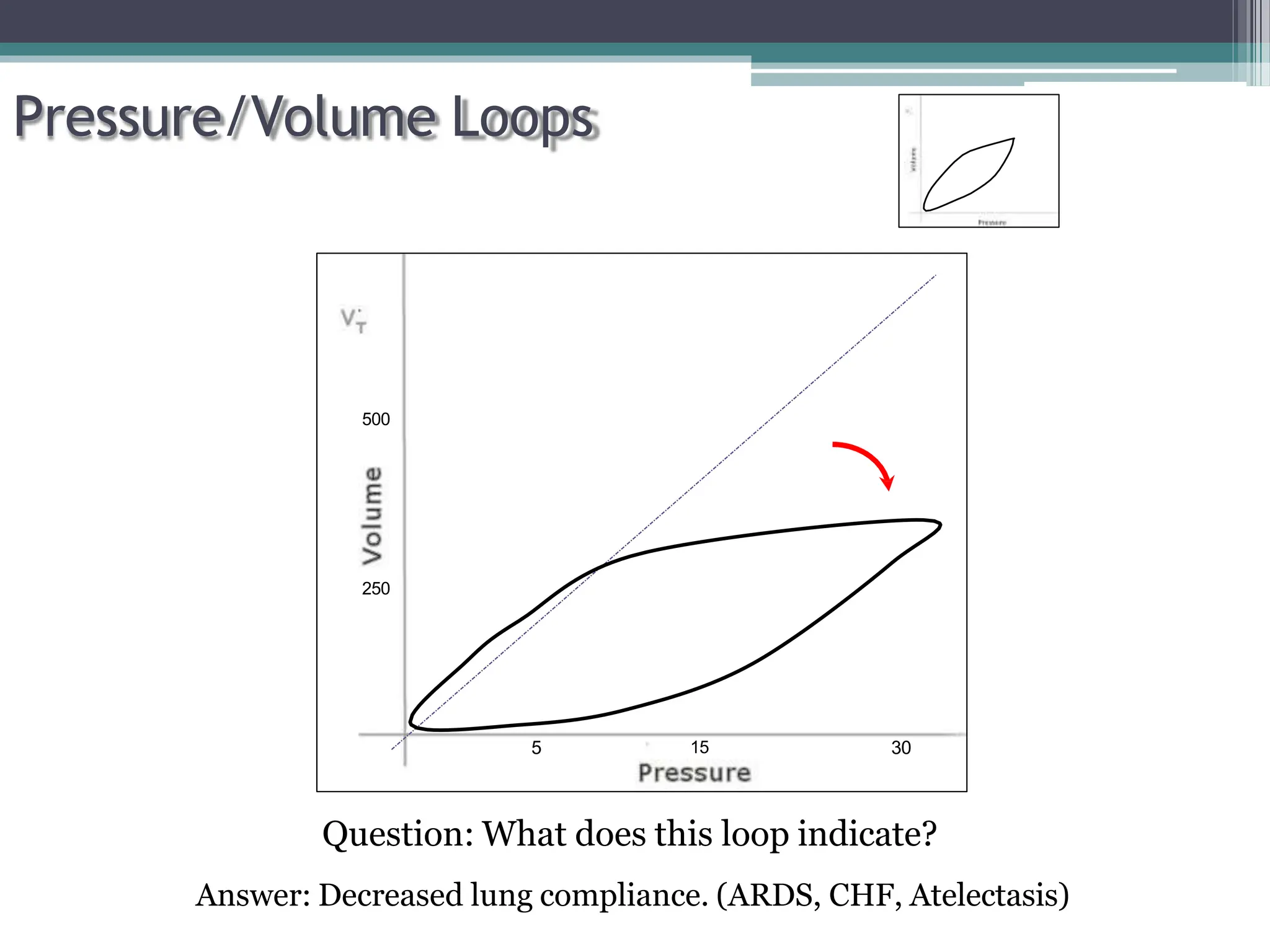 ventilator graphics in the ICU Patients ppt.pptx