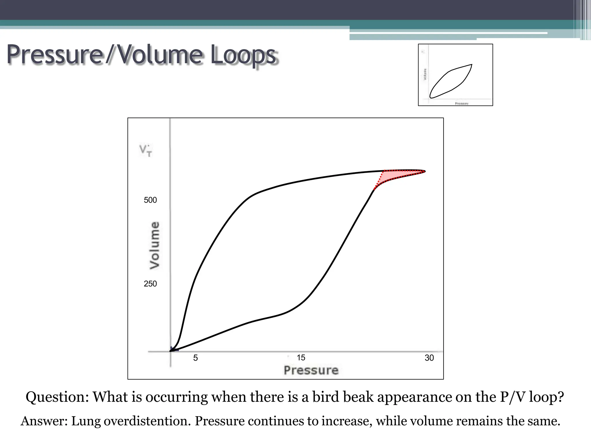 ventilator graphics in the ICU Patients ppt.pptx