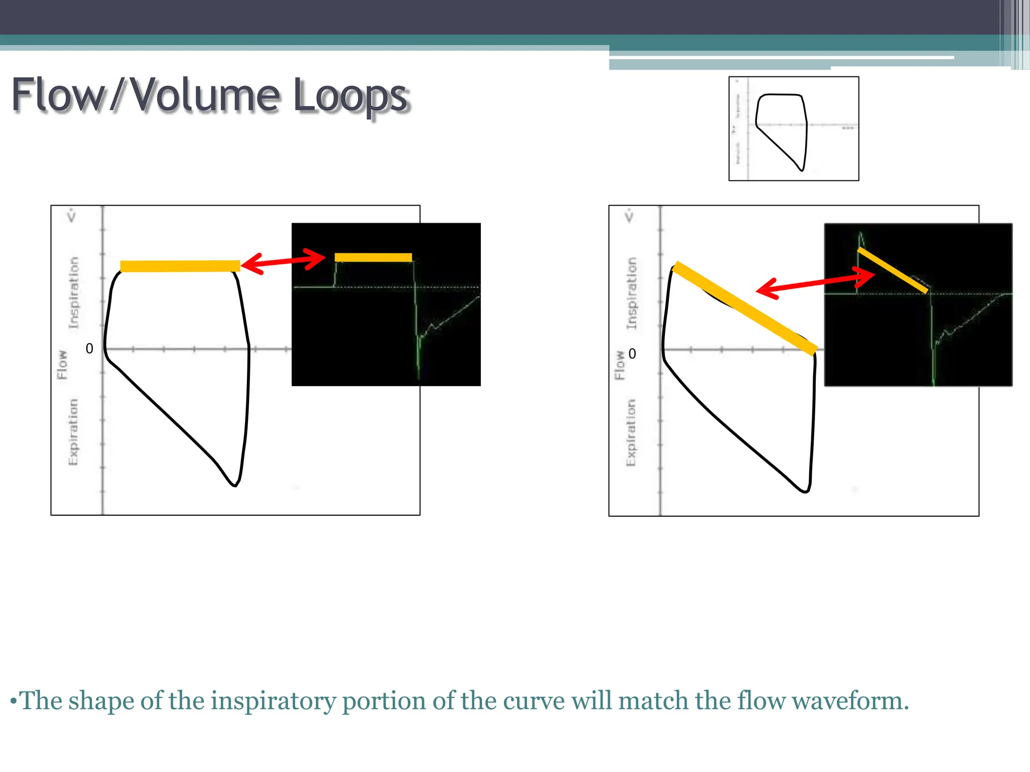 ventilator graphics in the ICU Patients ppt.pptx