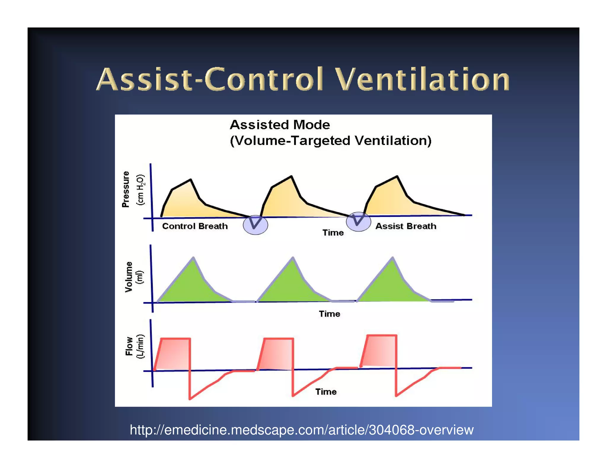 Ventilator Lecture.pdf