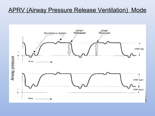 Ventilator mode | PPT