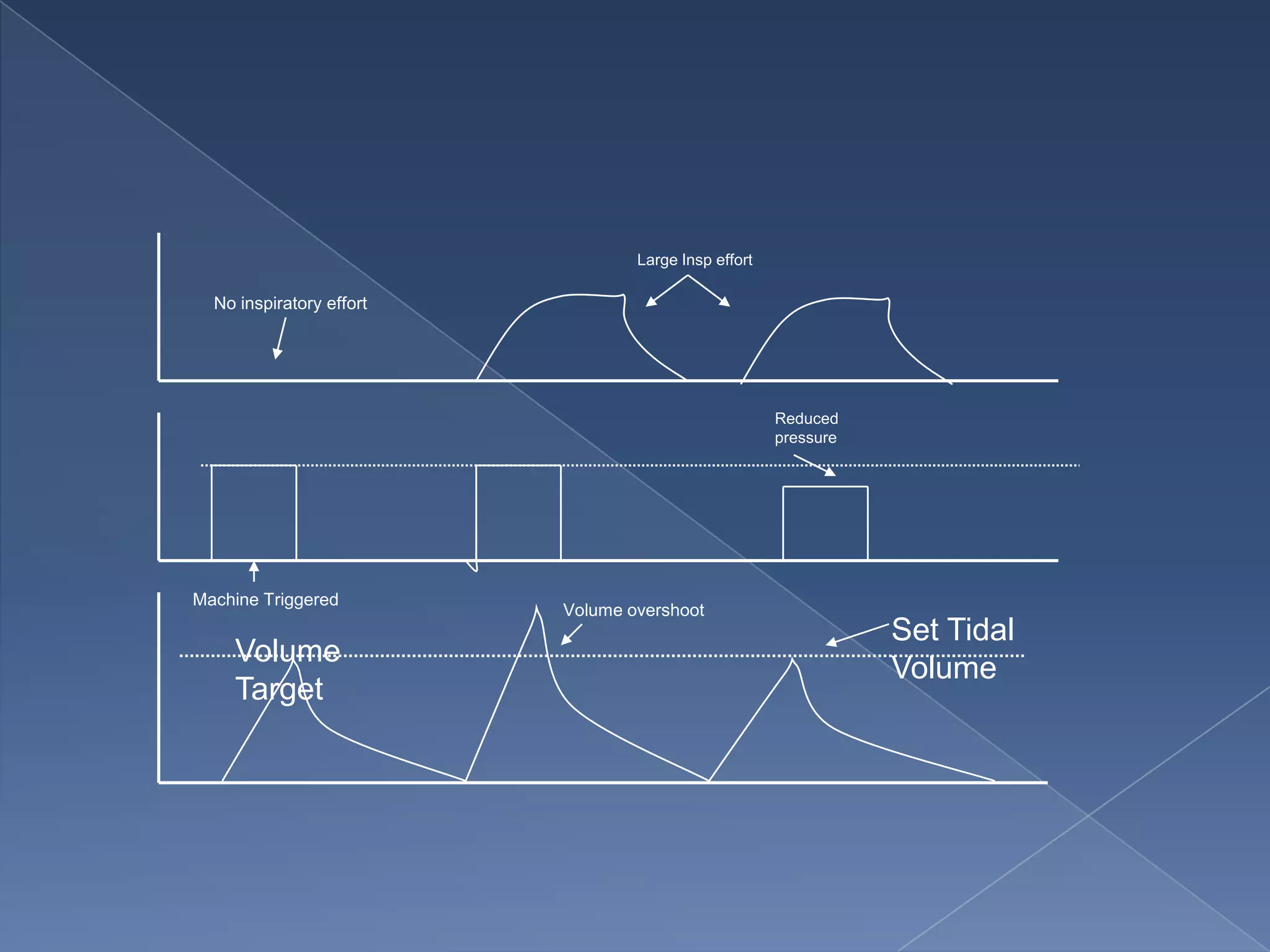 Ventilator mode classification | PPTX