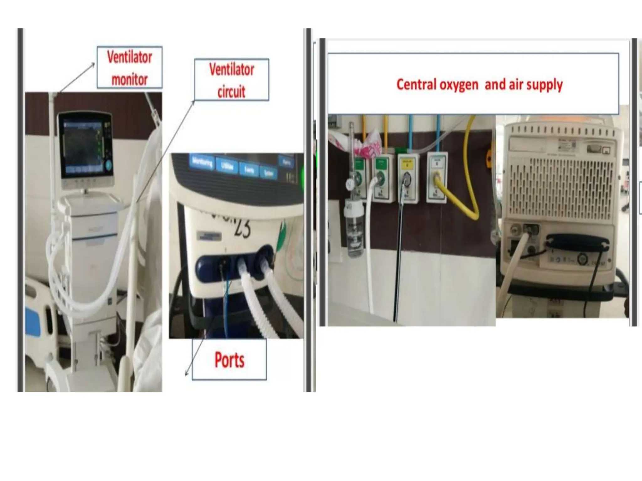 basic mecanical ventilation critical nursing.pptx