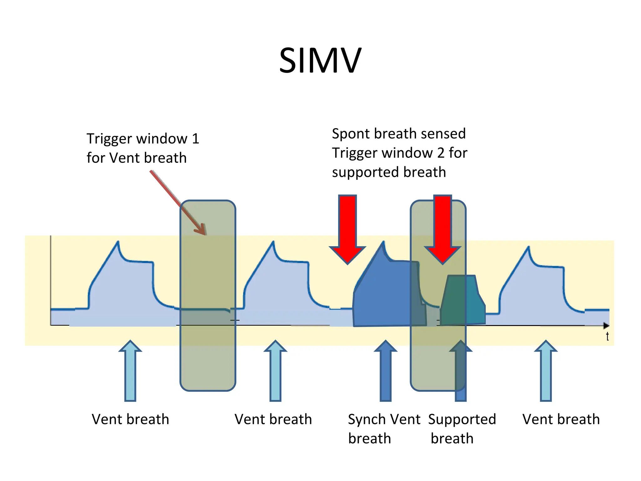 basic mecanical ventilation critical nursing.pptx