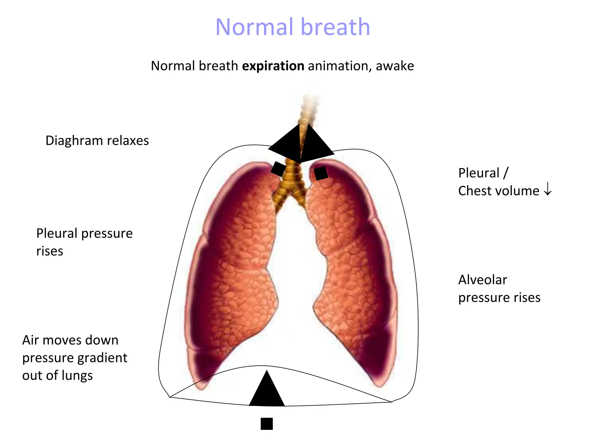 basic mecanical ventilation critical nursing.pptx