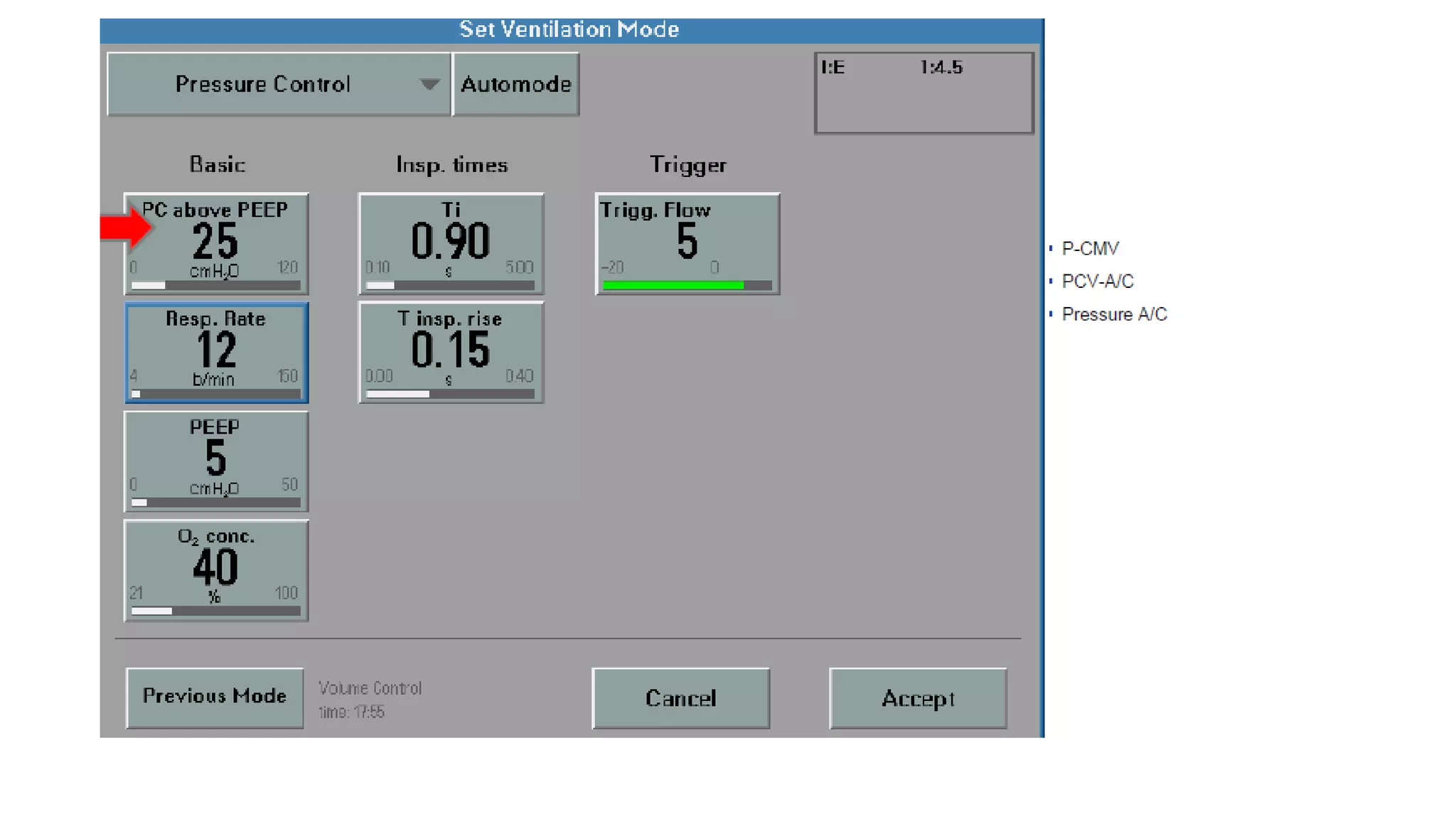 Ventilator setting | PDF