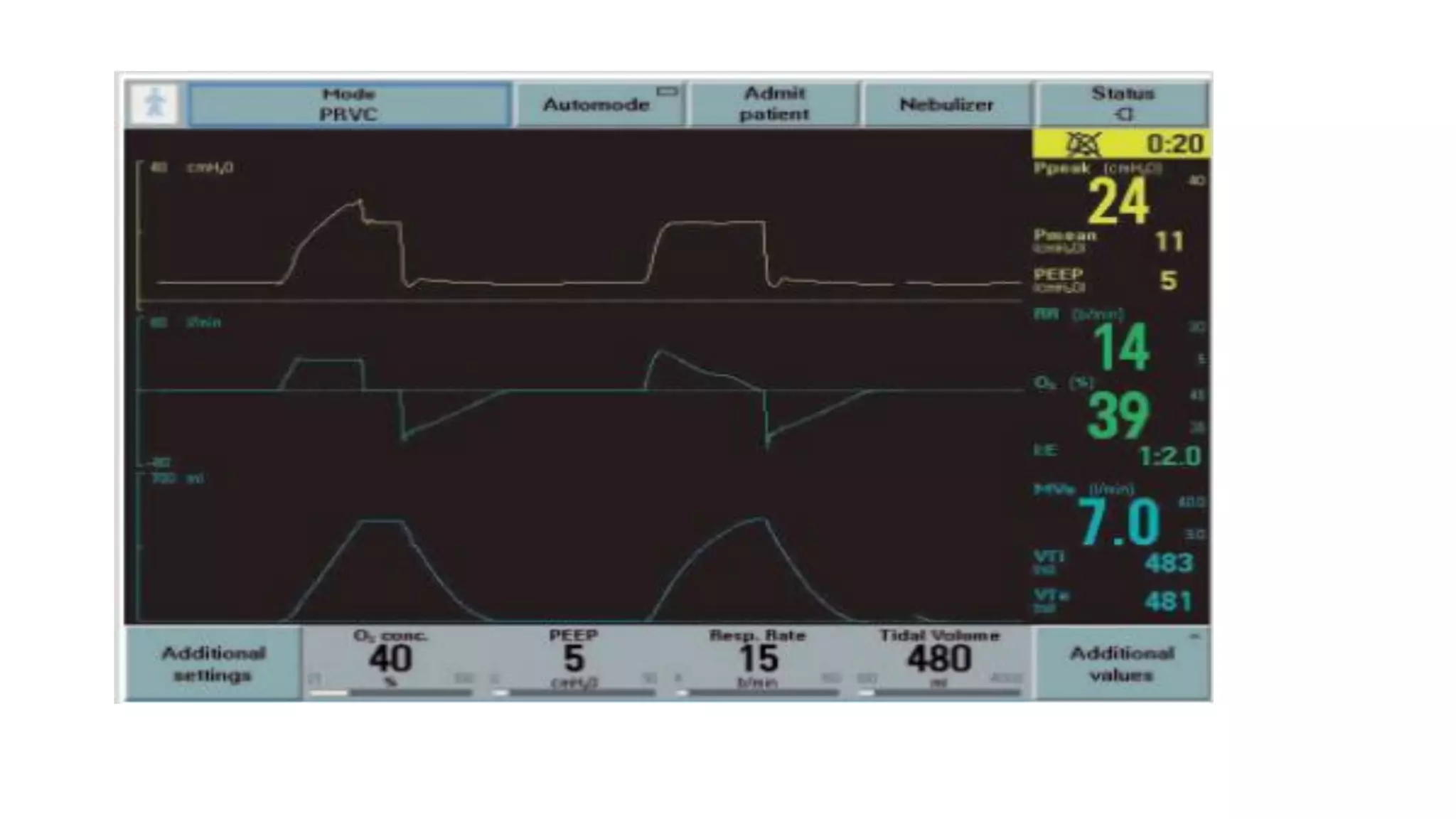 Ventilator setting | PDF