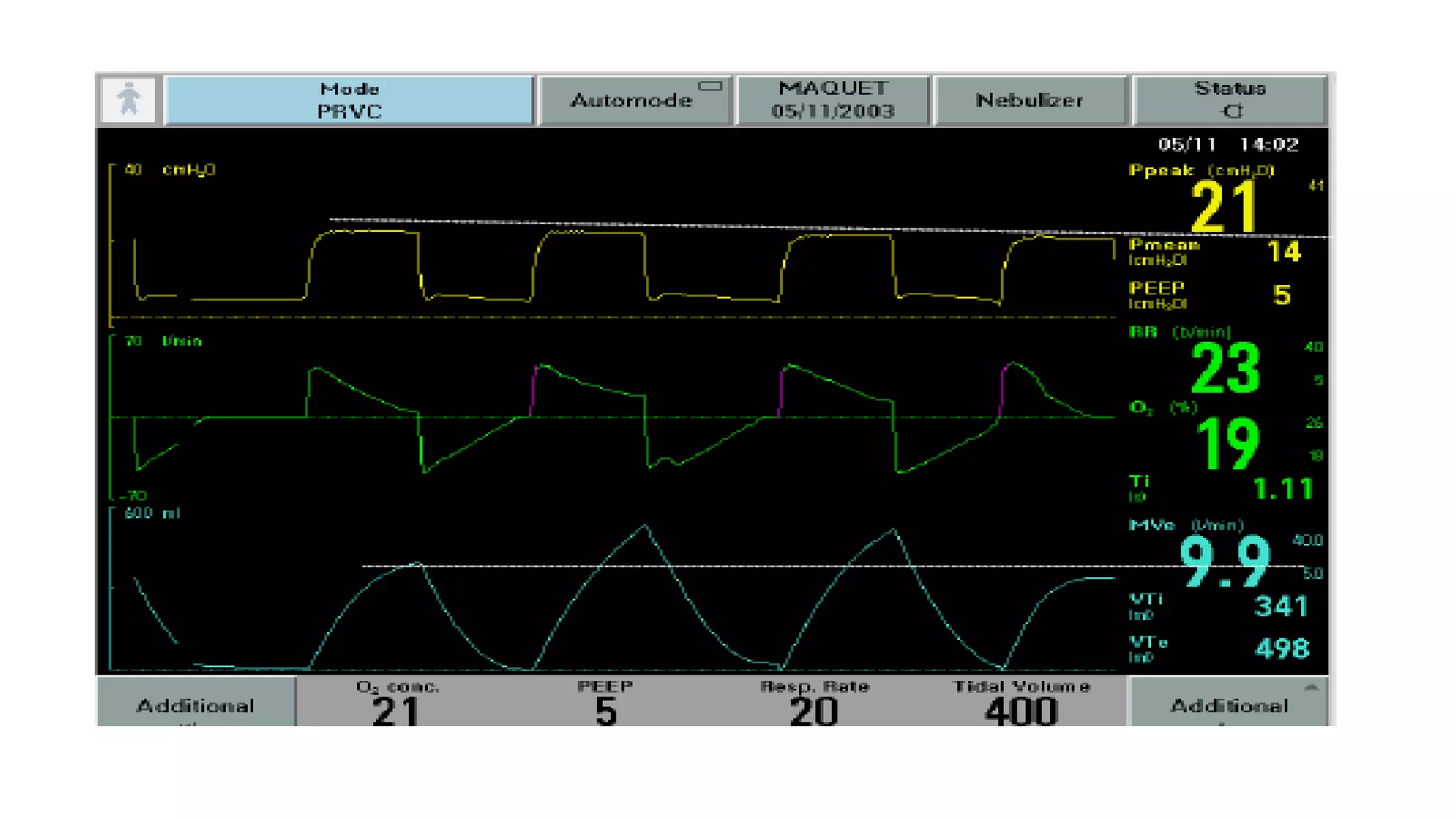 Ventilator setting | PDF