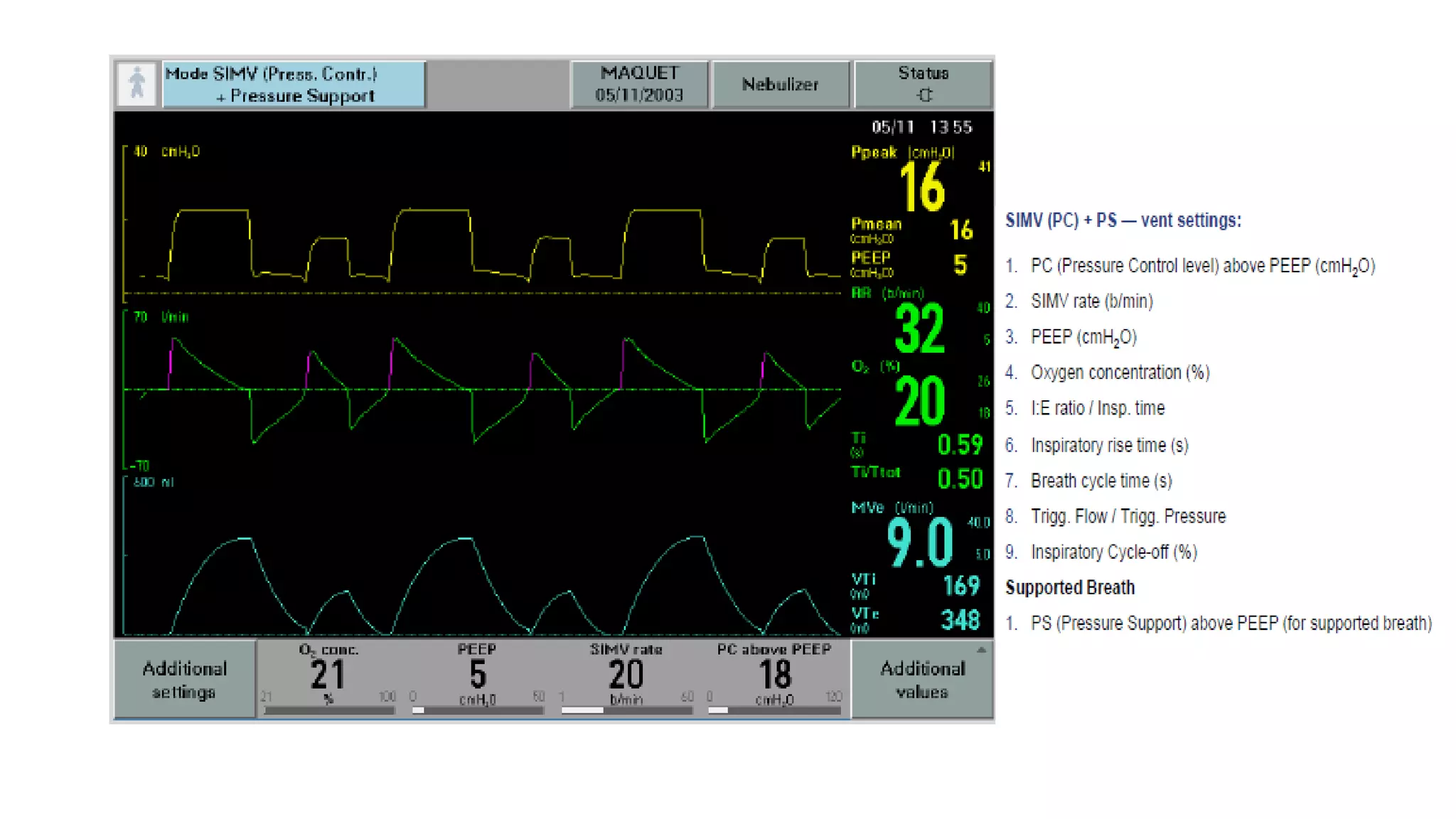 Ventilator setting | PDF