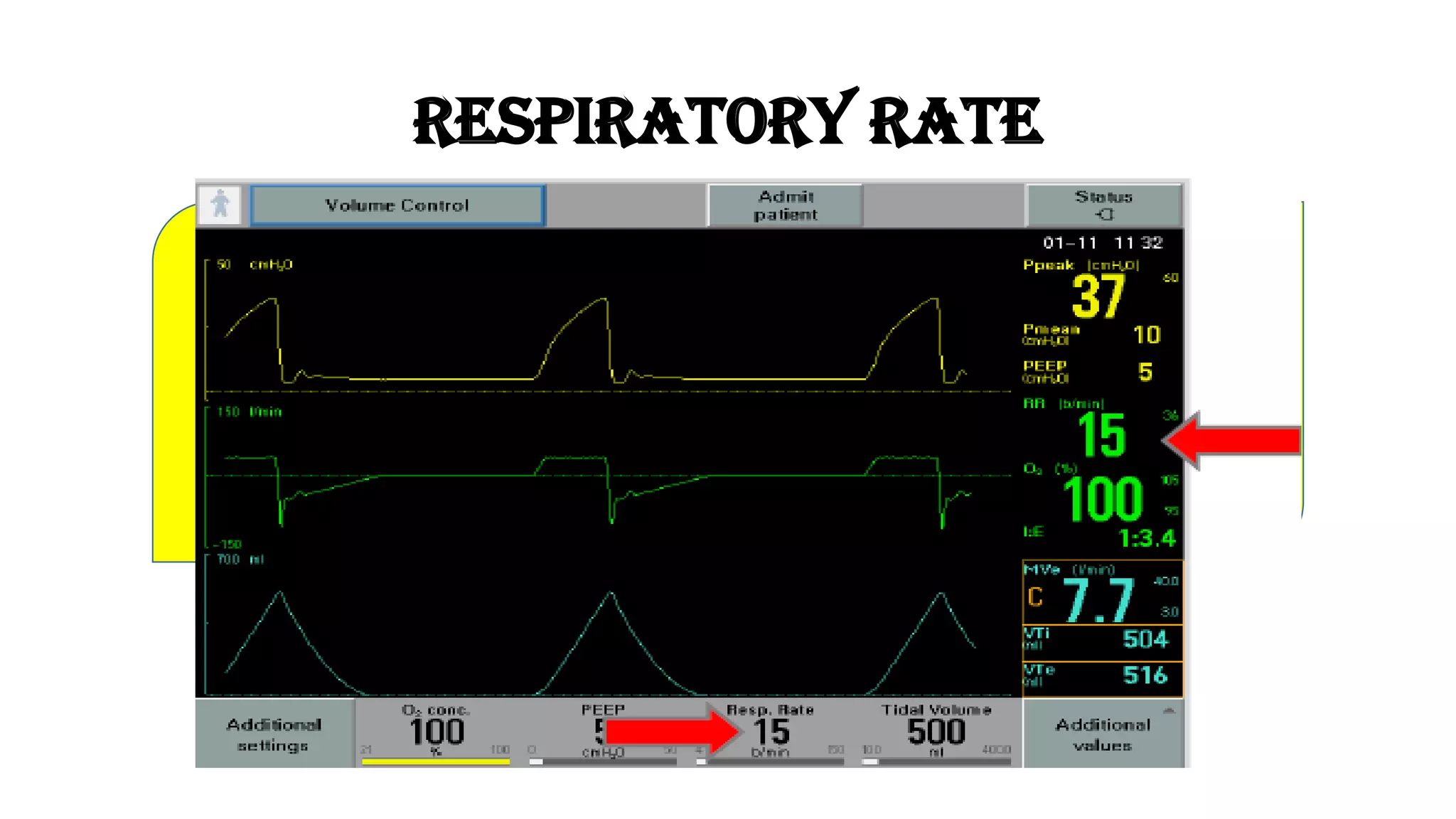 Ventilator setting | PDF