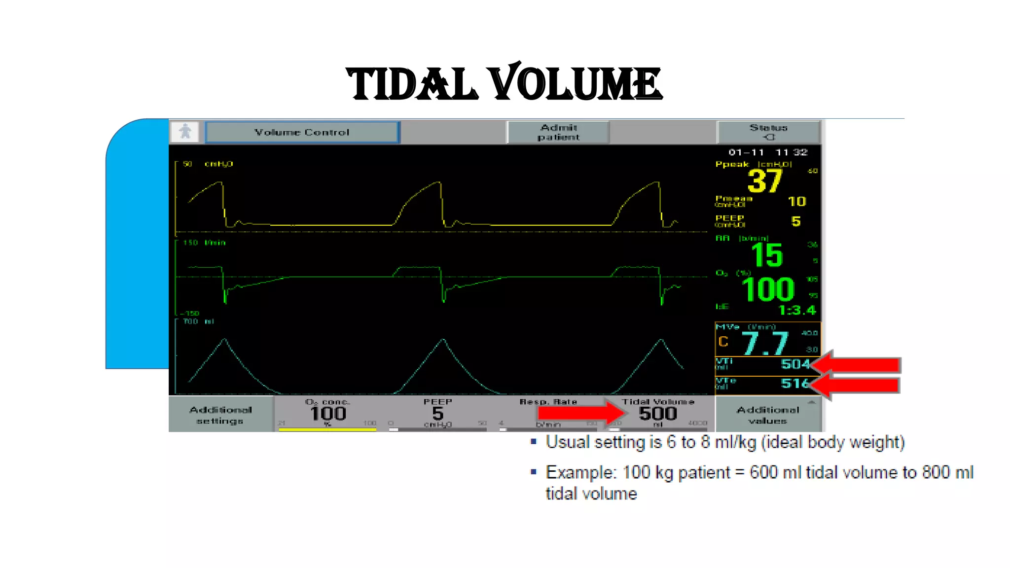 Ventilator setting | PDF