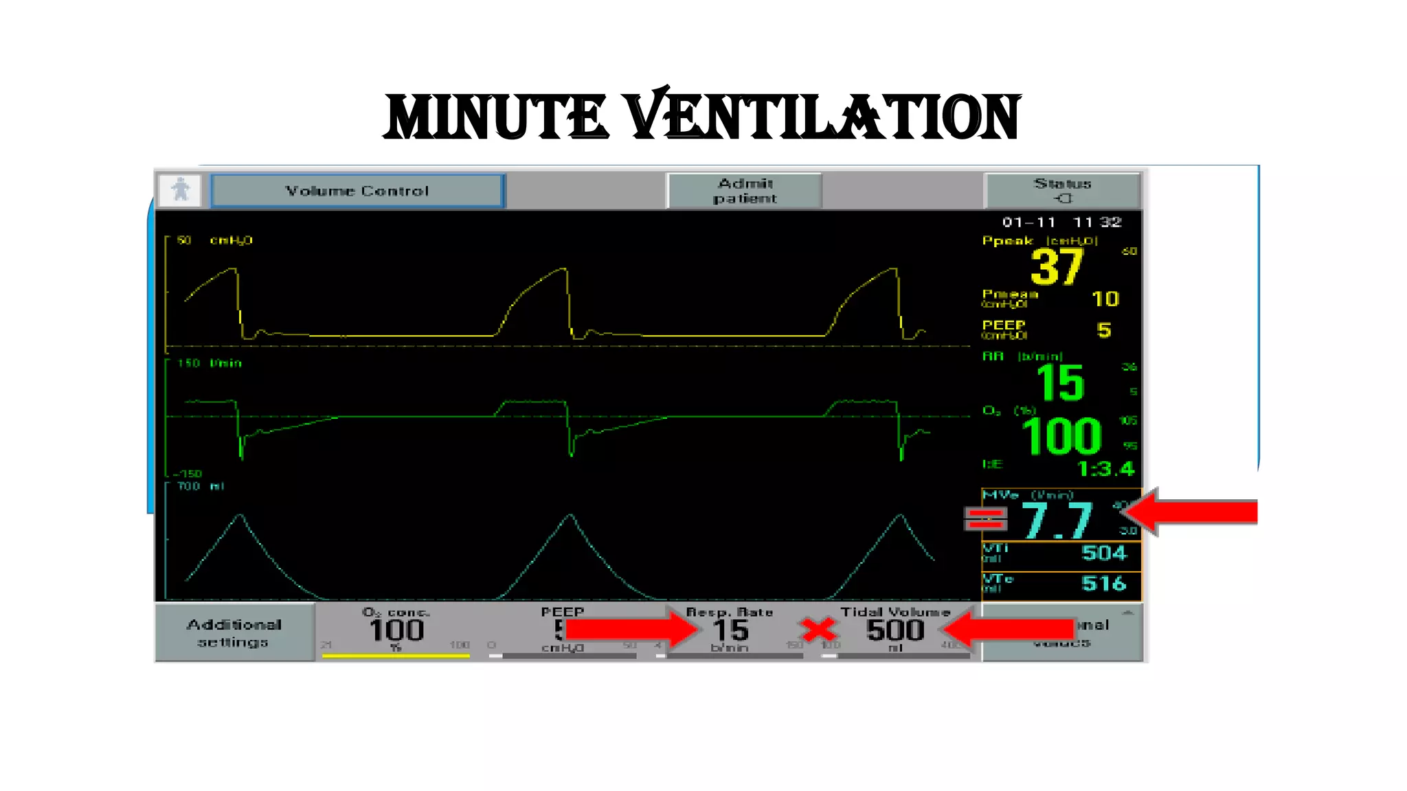 Ventilator setting | PDF