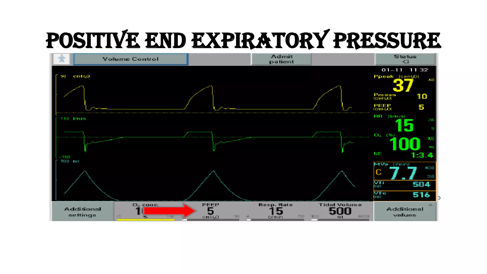 Ventilator setting | PDF