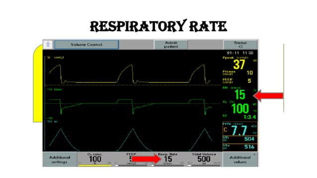 Ventilator setting | PDF | Lung and Respiratory Health | Diseases and ...