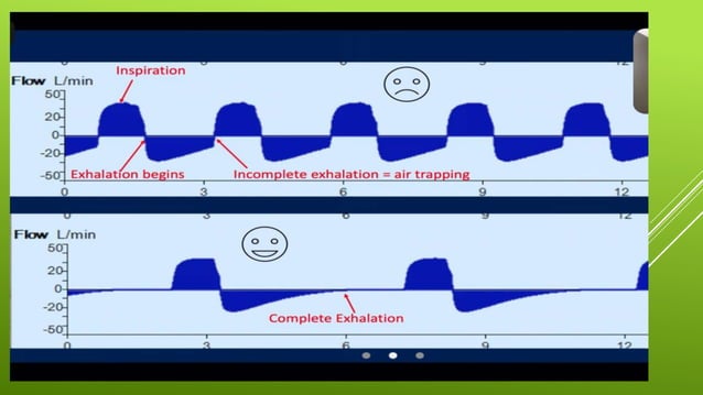 Ventilator troubleshooting in ICU Hospital.pptx