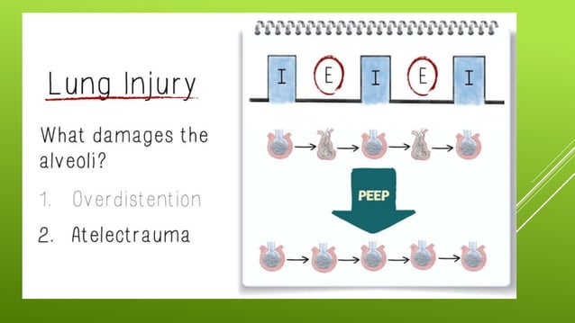 Ventilator troubleshooting in ICU Hospital.pptx