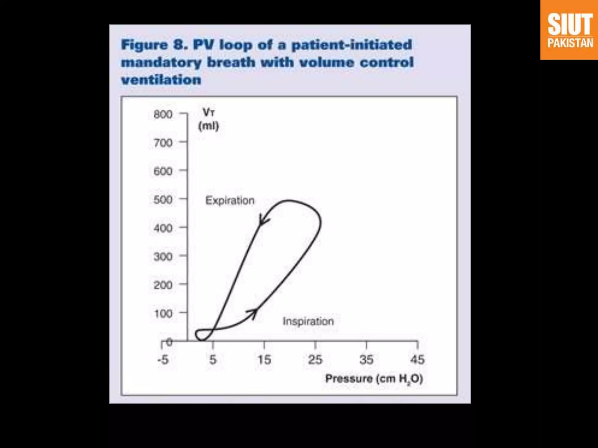 Ventilator waveforms | PPTX