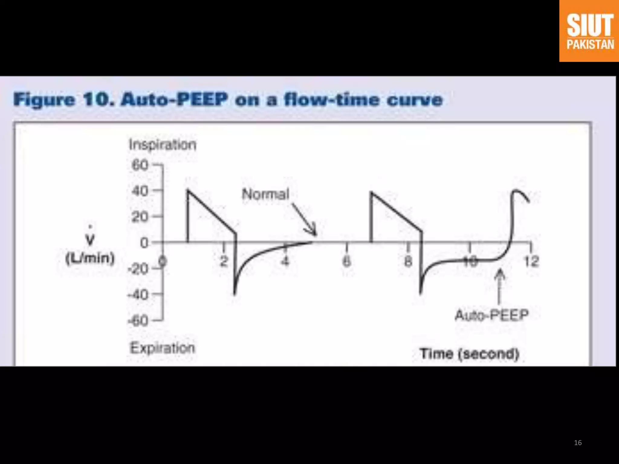 Ventilator waveforms | PPTX