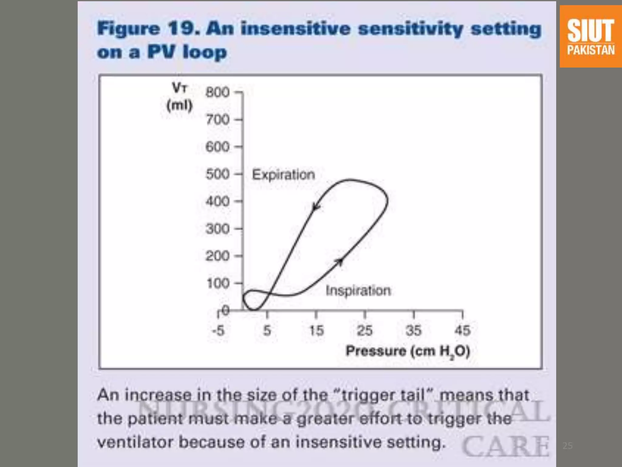 Ventilator waveforms | PPTX