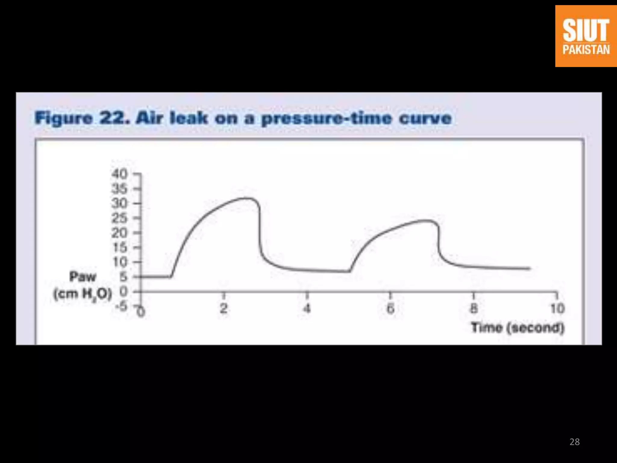 Ventilator waveforms | PPTX
