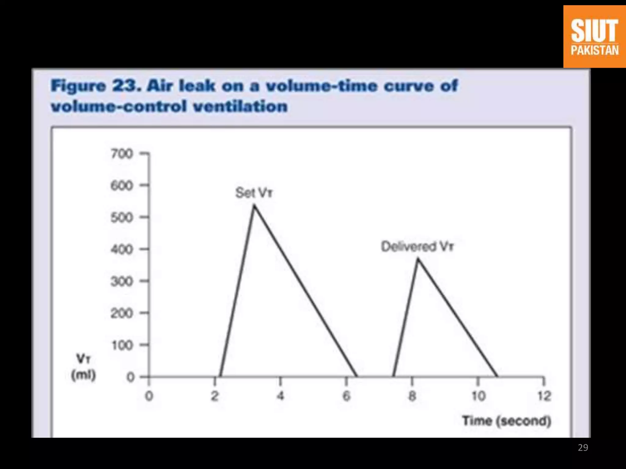 Ventilator waveforms | PPTX