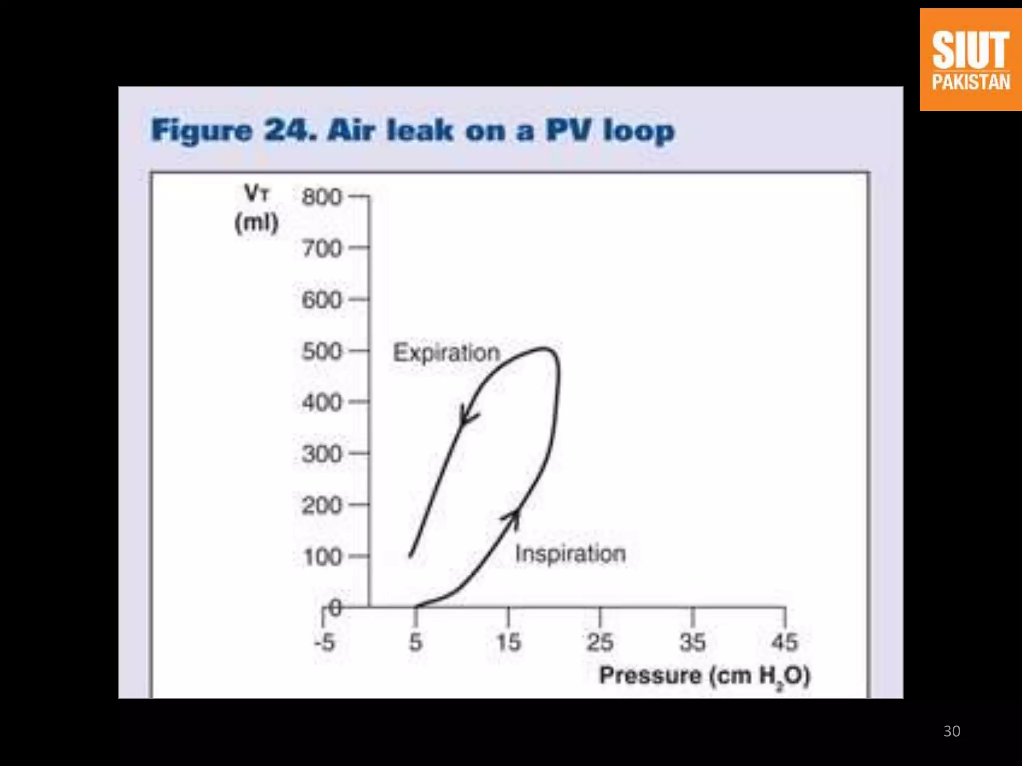 Ventilator waveforms | PPTX