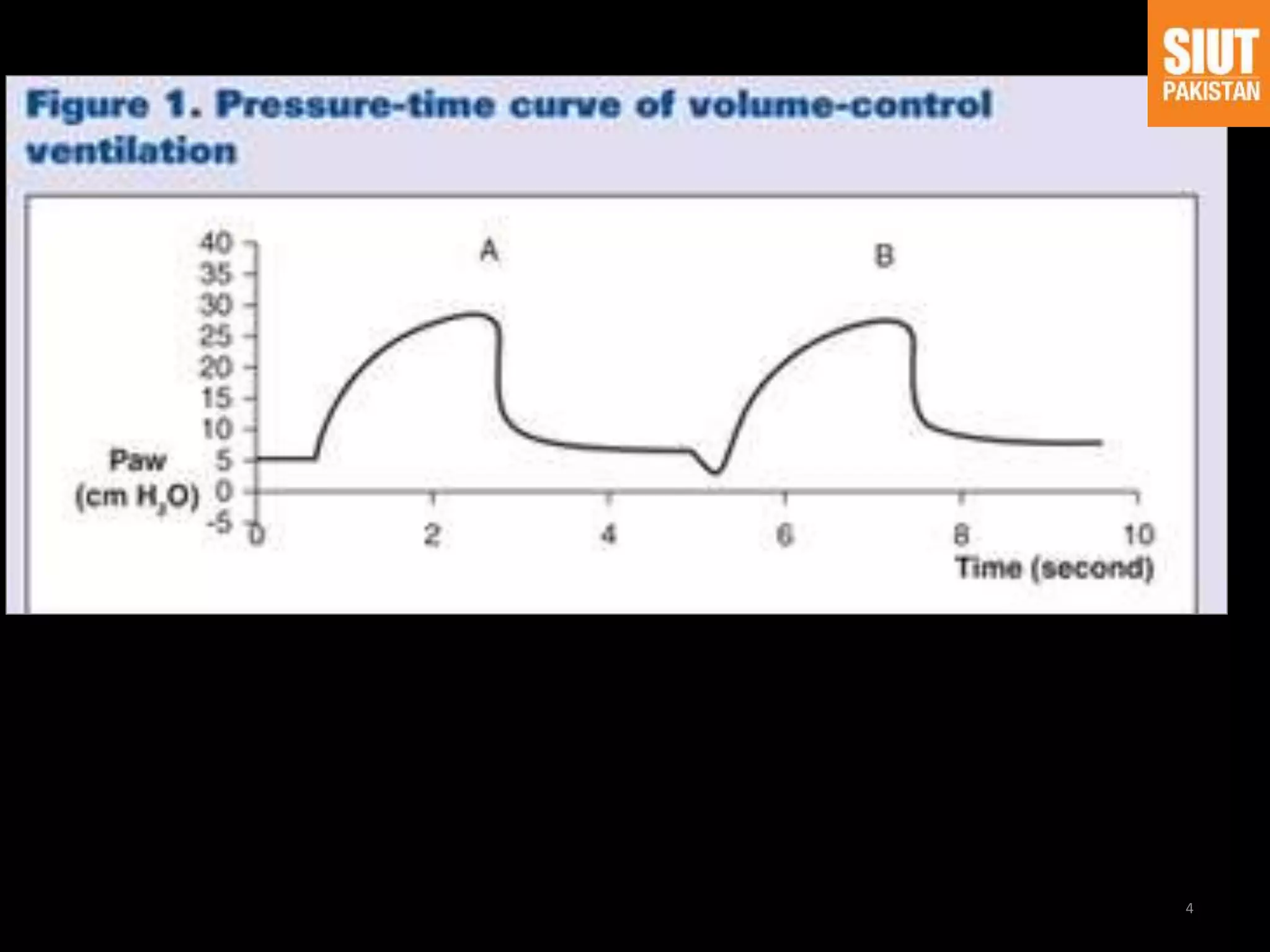 Ventilator waveforms | PPTX