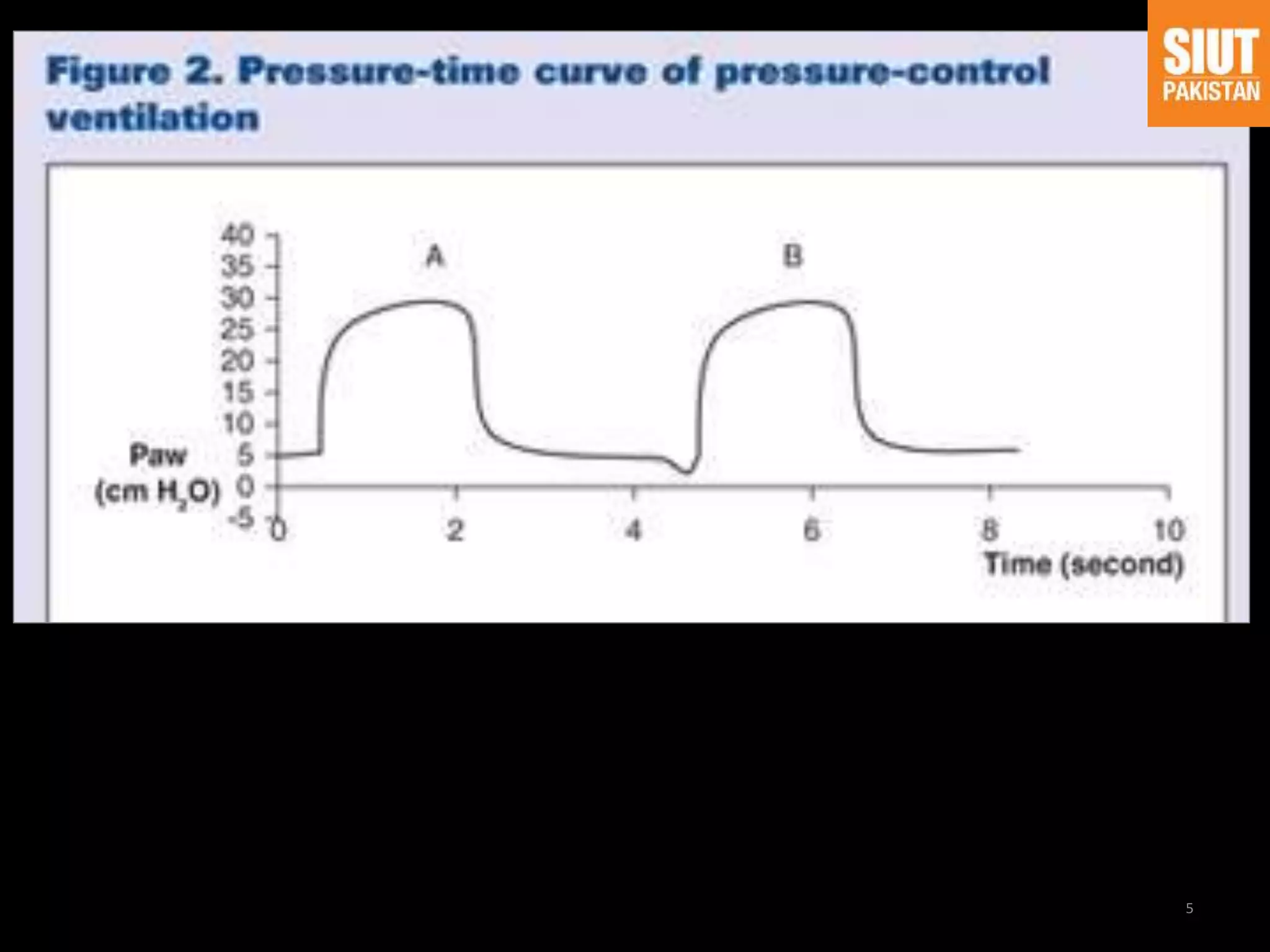 Ventilator waveforms | PPTX