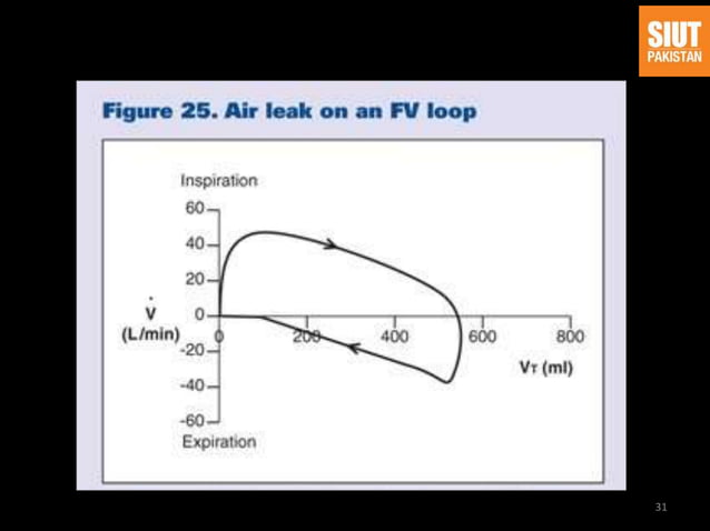 Ventilator waveforms | PPT