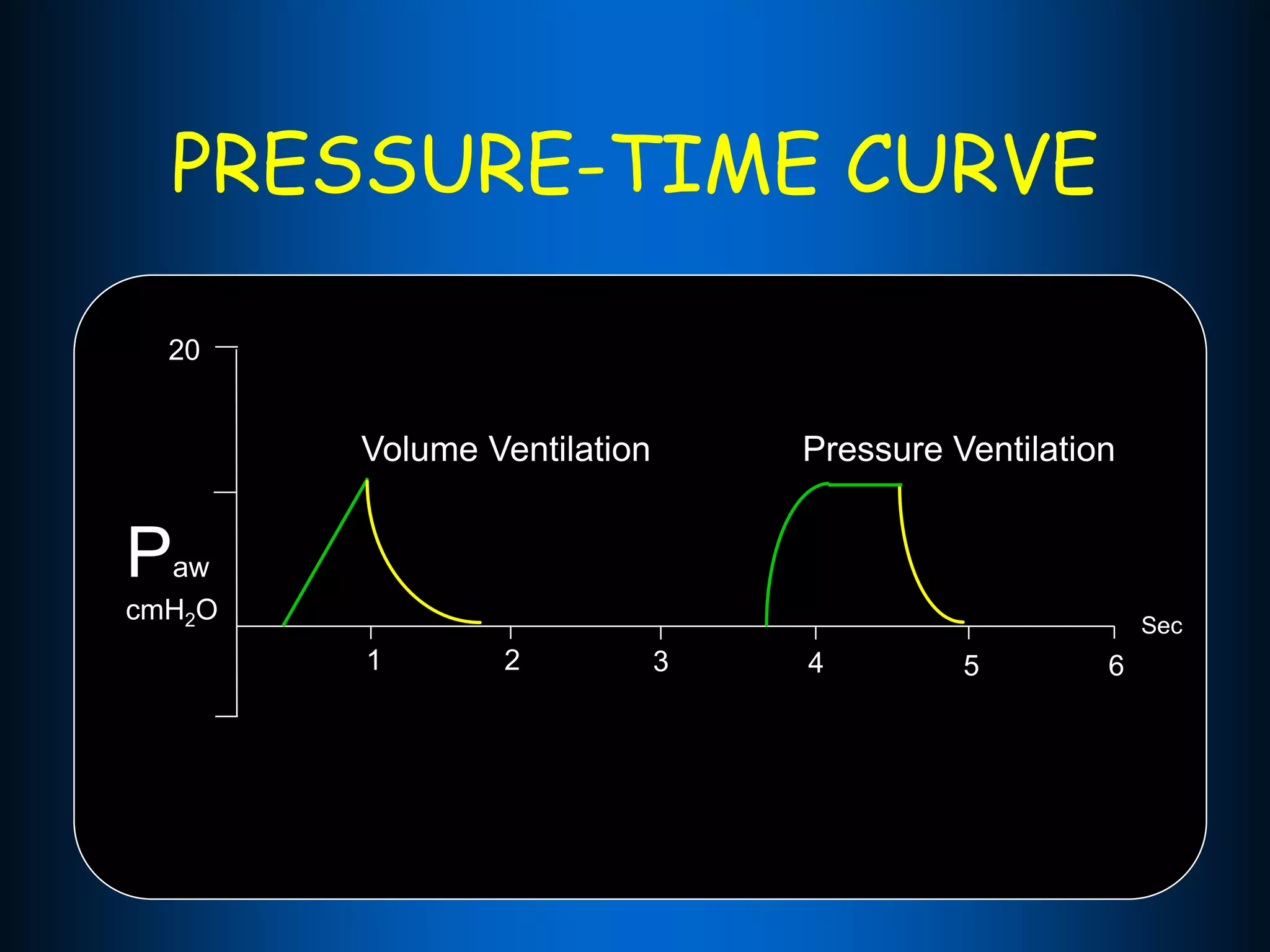ventilator waveforms Dr Sanjay Chugh.pptx