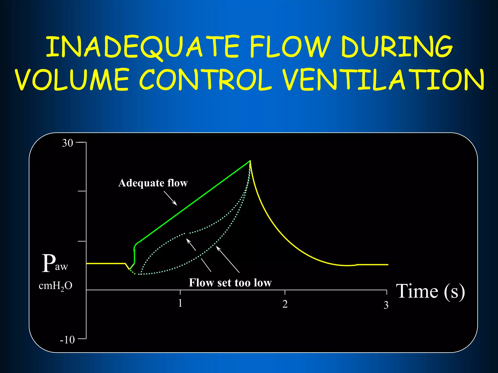 ventilator waveforms Dr Sanjay Chugh.pptx