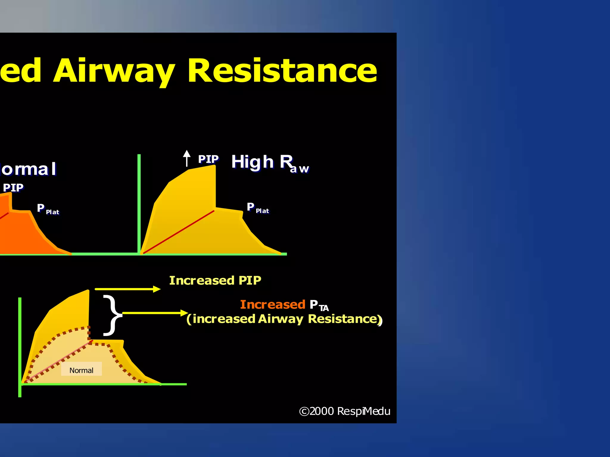 ventilator waveforms Dr Sanjay Chugh.pptx