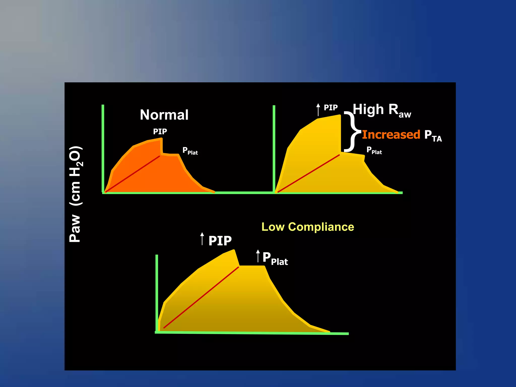 ventilator waveforms Dr Sanjay Chugh.pptx