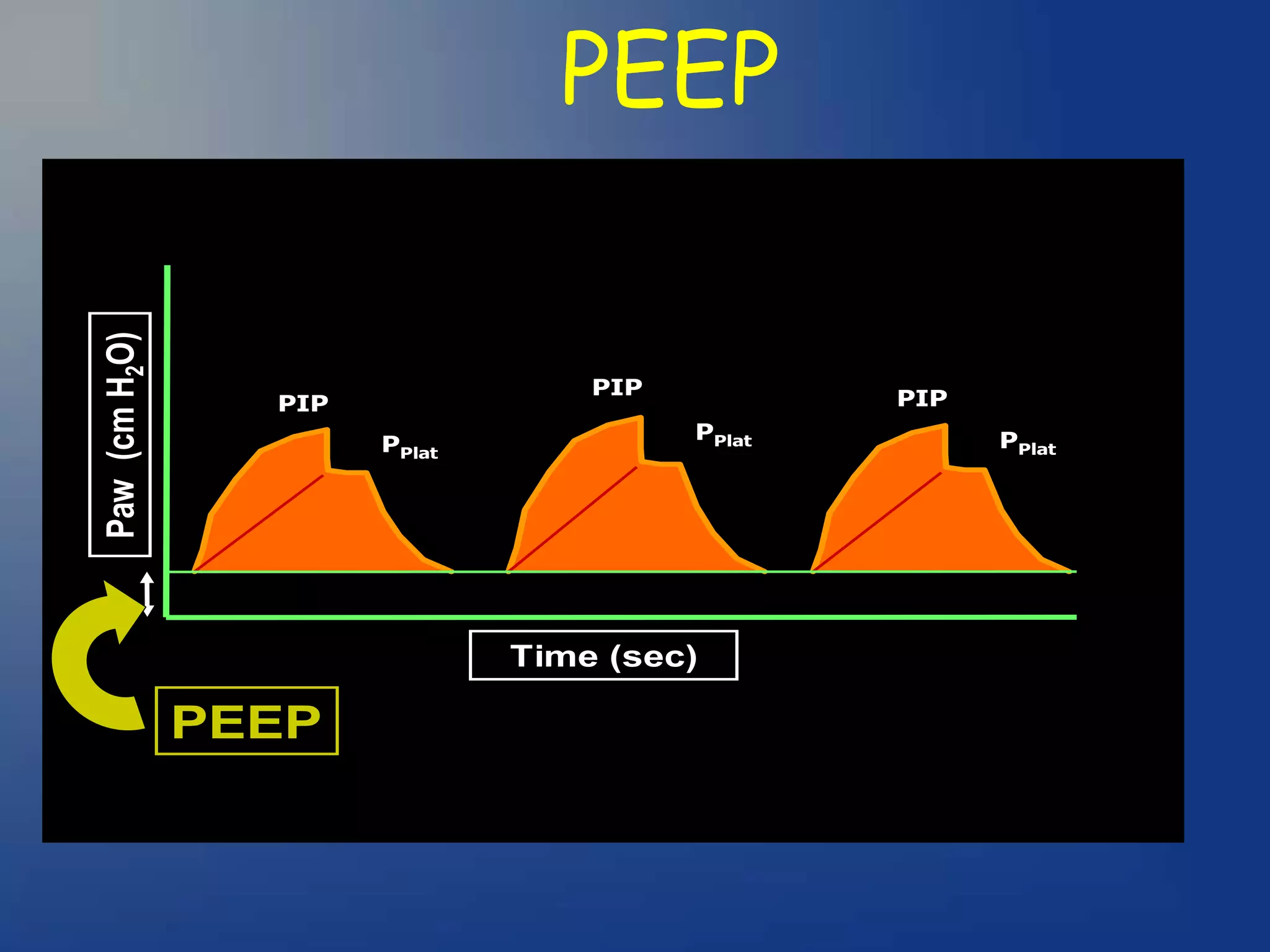 ventilator waveforms Dr Sanjay Chugh.pptx