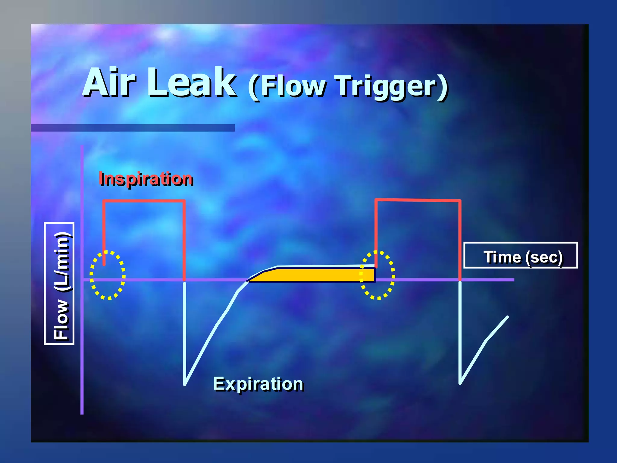 Ventilator Waveforms Dr Sanjay Chugh Pptx