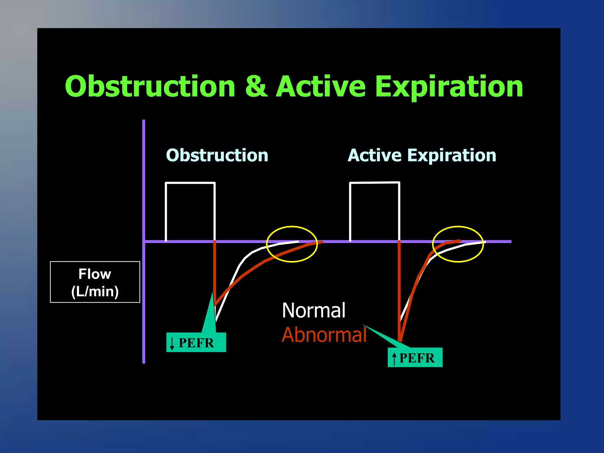 ventilator waveforms Dr Sanjay Chugh.pptx