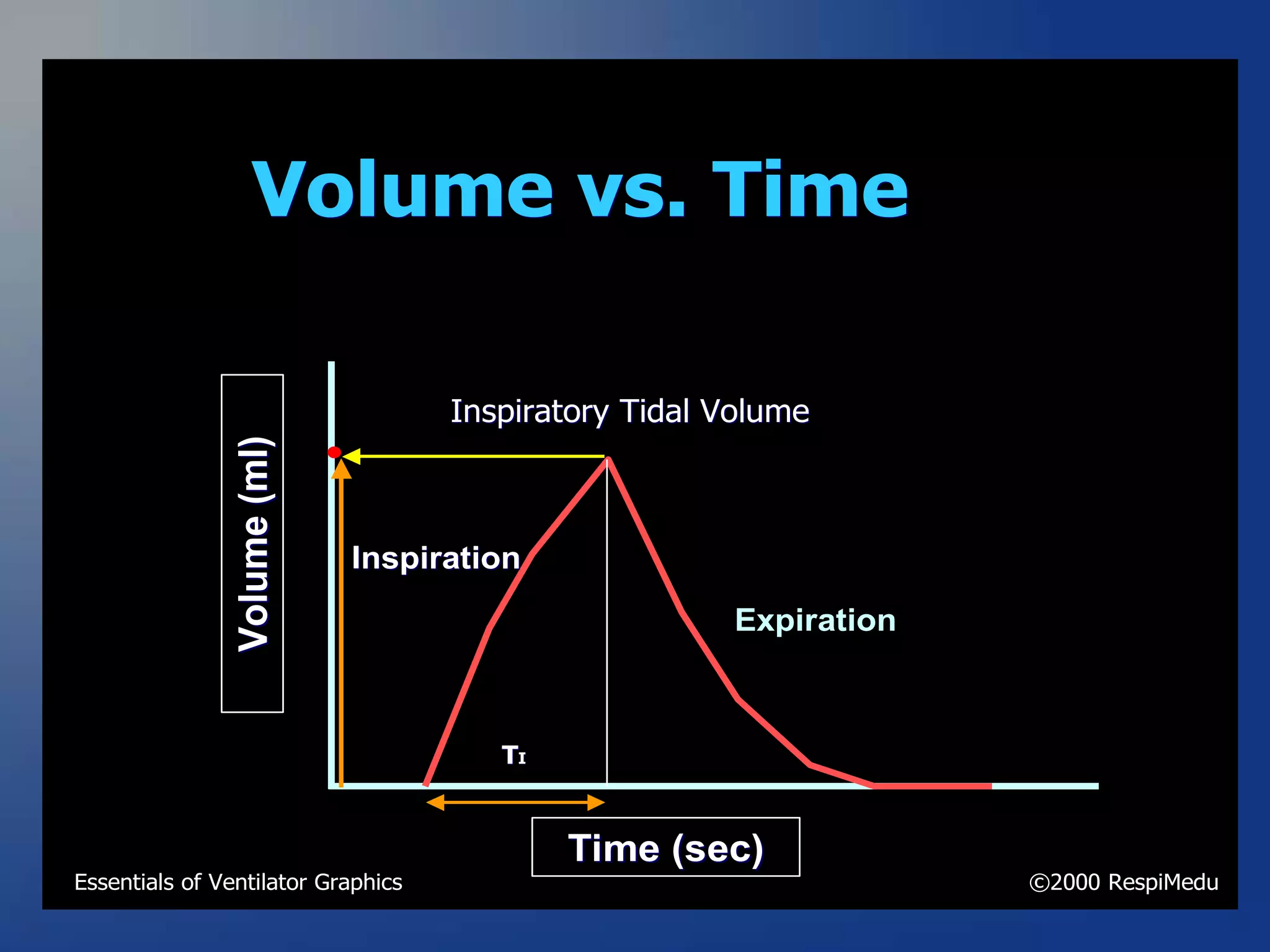 ventilator waveforms Dr Sanjay Chugh.pptx