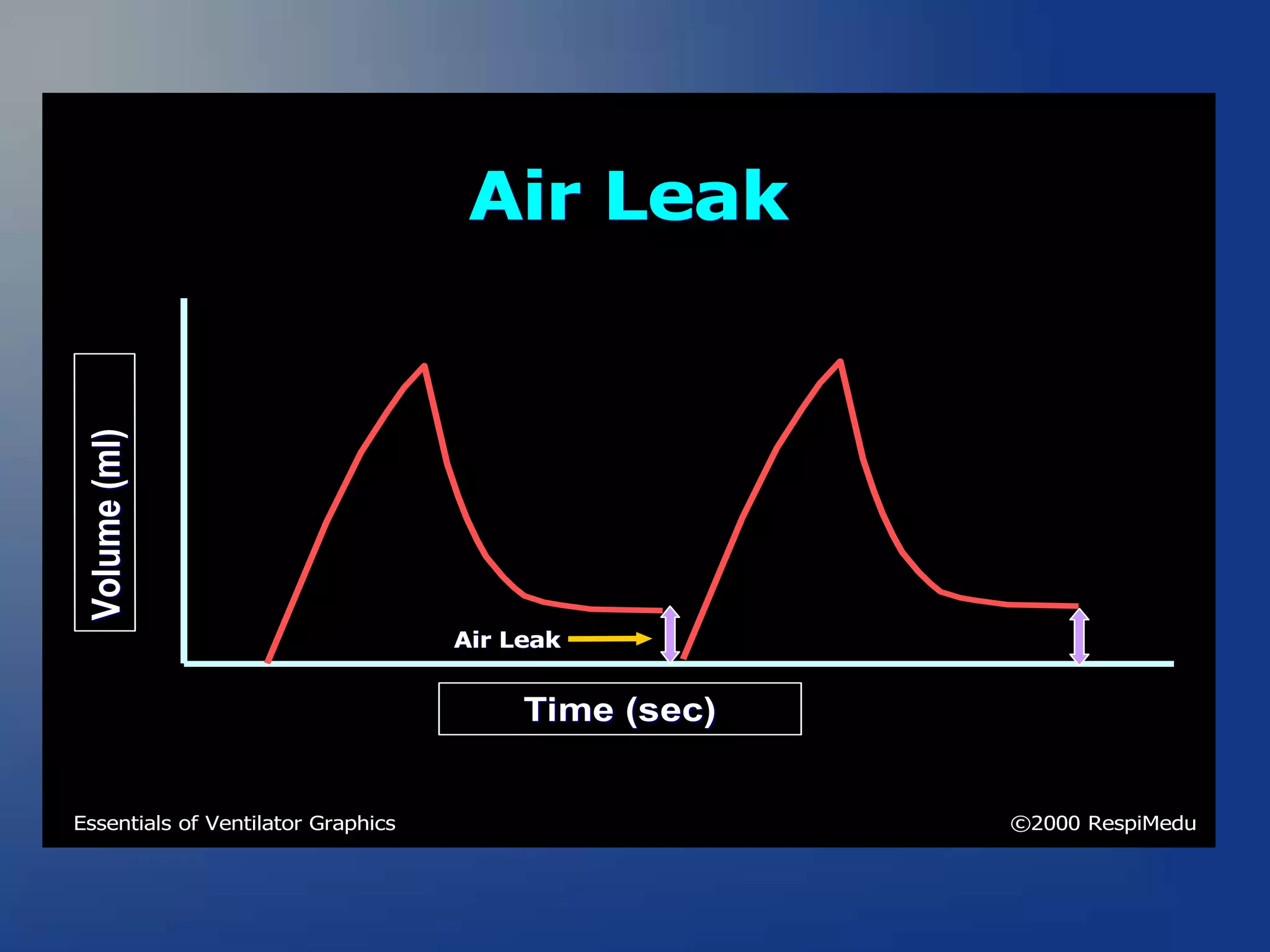 ventilator waveforms Dr Sanjay Chugh.pptx