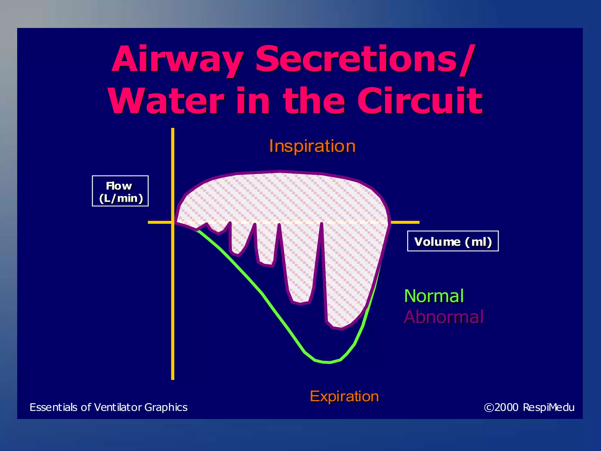 ventilator waveforms Dr Sanjay Chugh.pptx