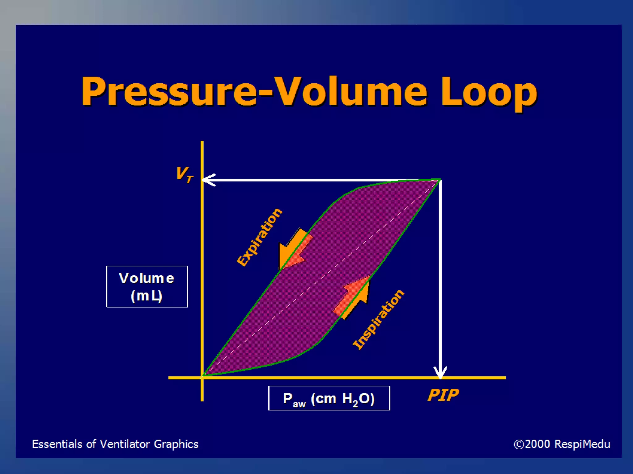 ventilator waveforms Dr Sanjay Chugh.pptx